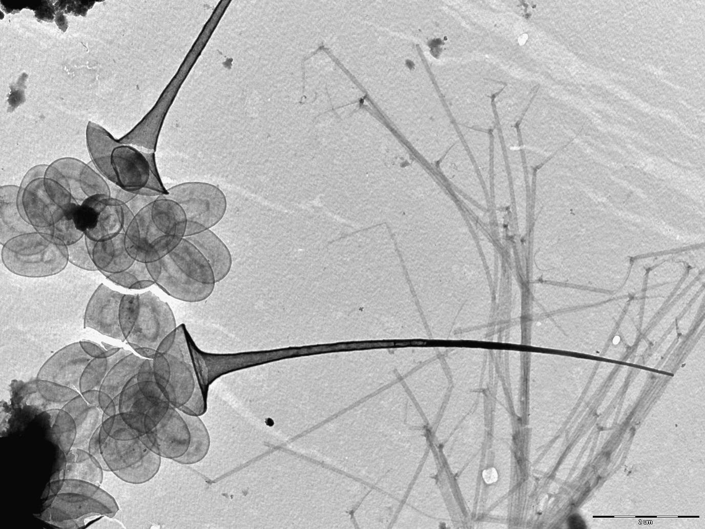 Spiniferomonas bourrellyi | Silica-scaled chrysophytes of Europe